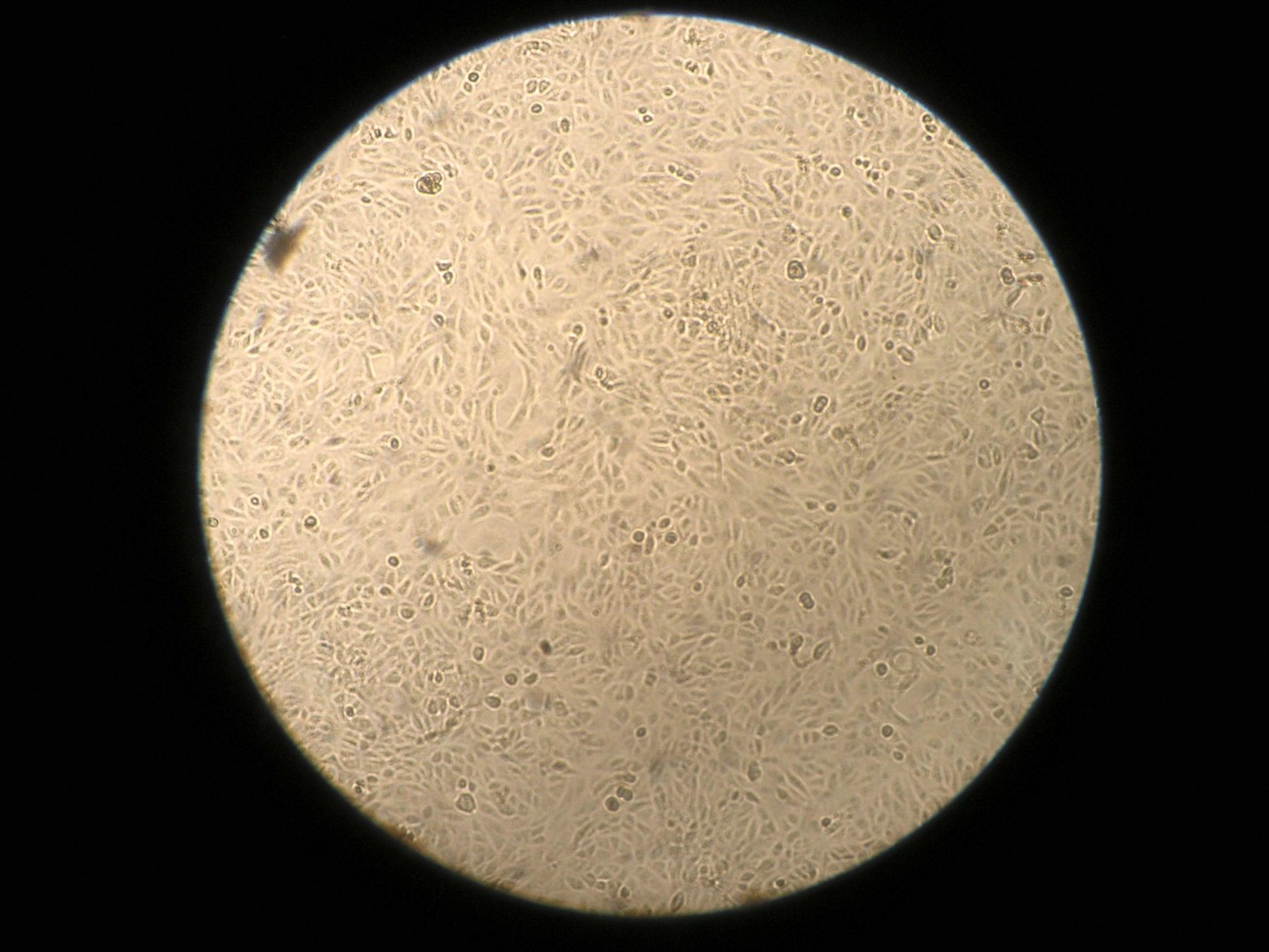 Vero's cells are seen through a microscope at a cell culture laboratory ...