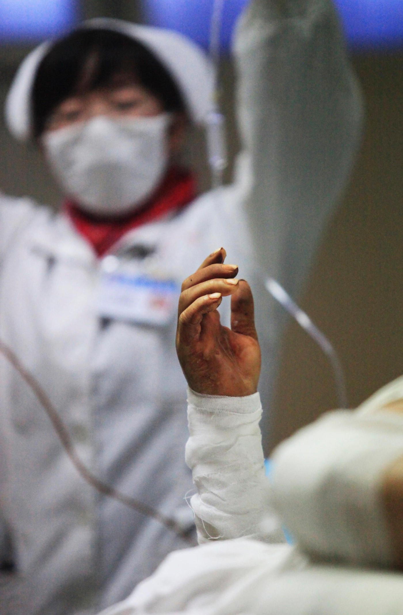 An injured man's hand is wrapped with bandages as he receives medical ...